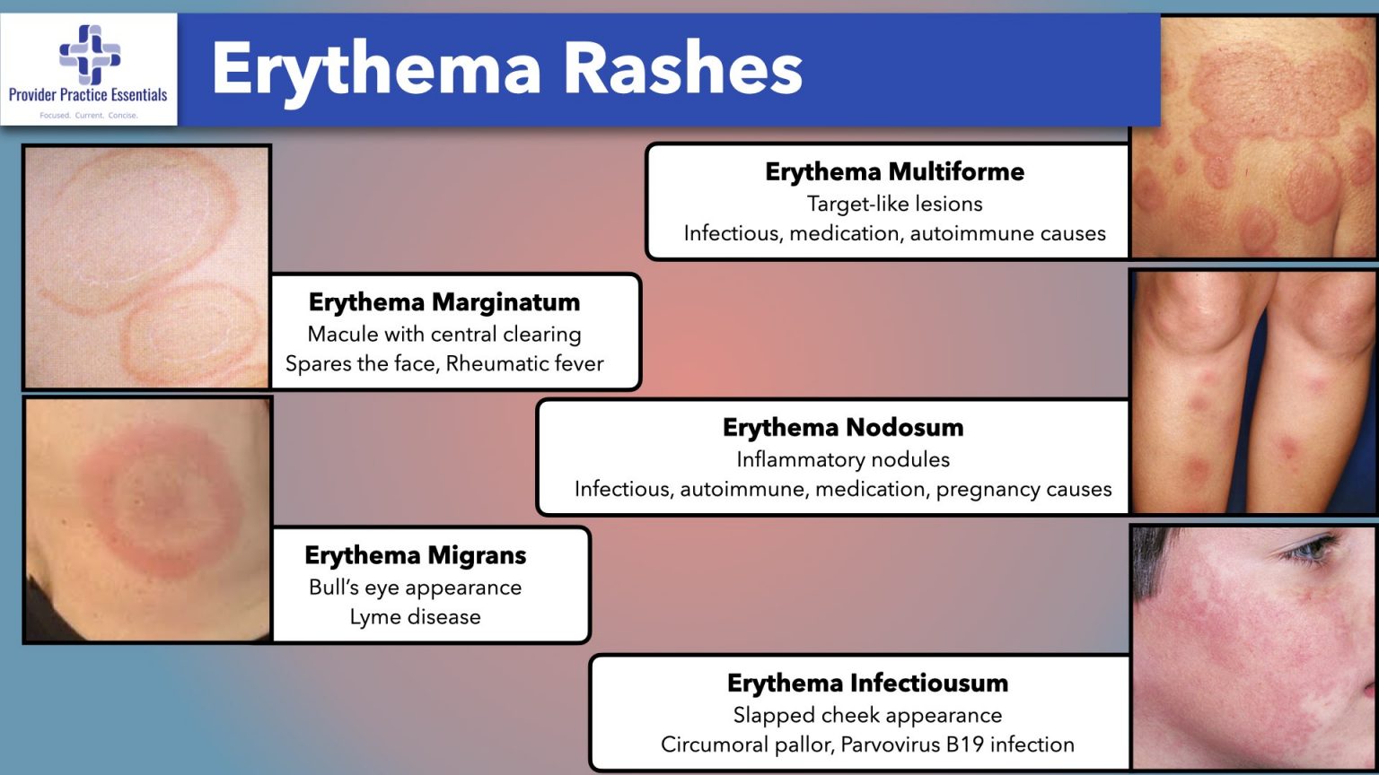 Pediatric Rashes