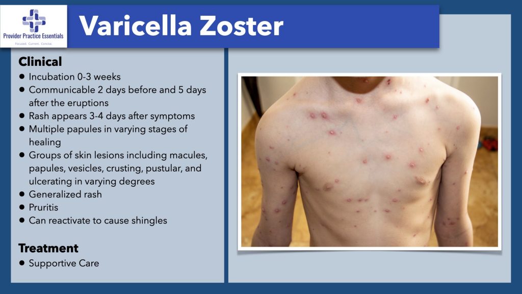 Pediatric Rashes