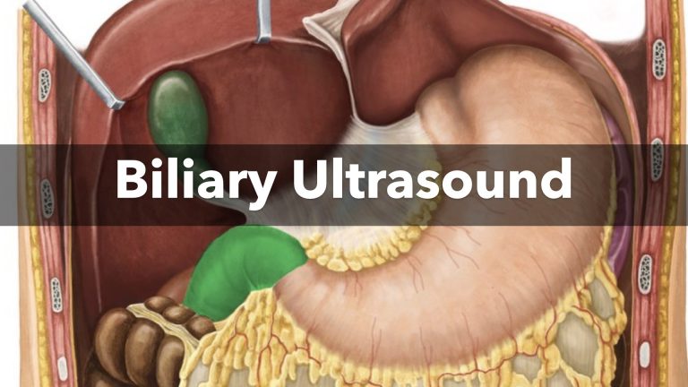 Diverticulitis Management: Outpatient or Inpatient - Current Treatment