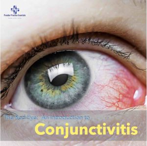 The Red Eye: An Intro to Conjunctivitis