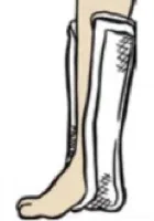 Splinting Guide