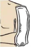 Splinting Guide
