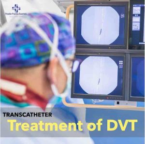 Deep Venous Thrombosis Treatment Options